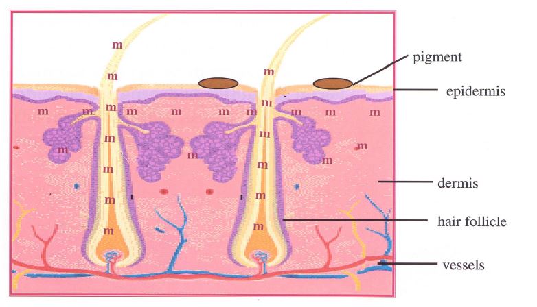 Intense Pulsed Light (IPL)
